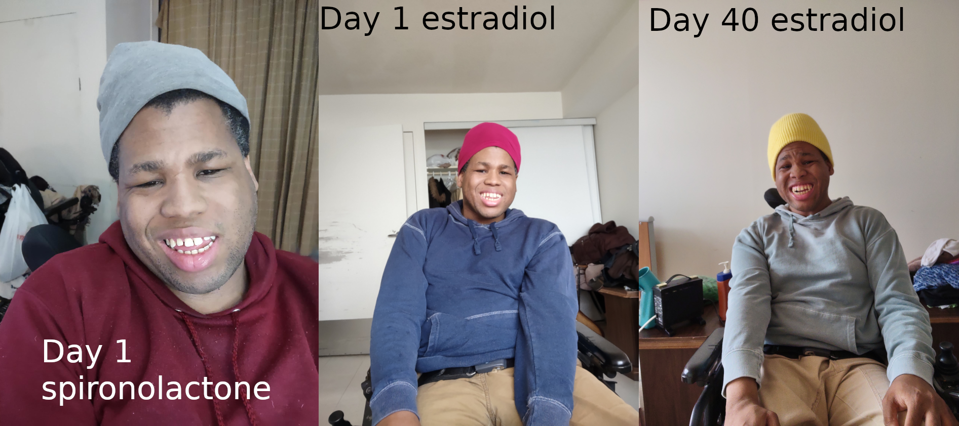 Trans Timelines — Raddle